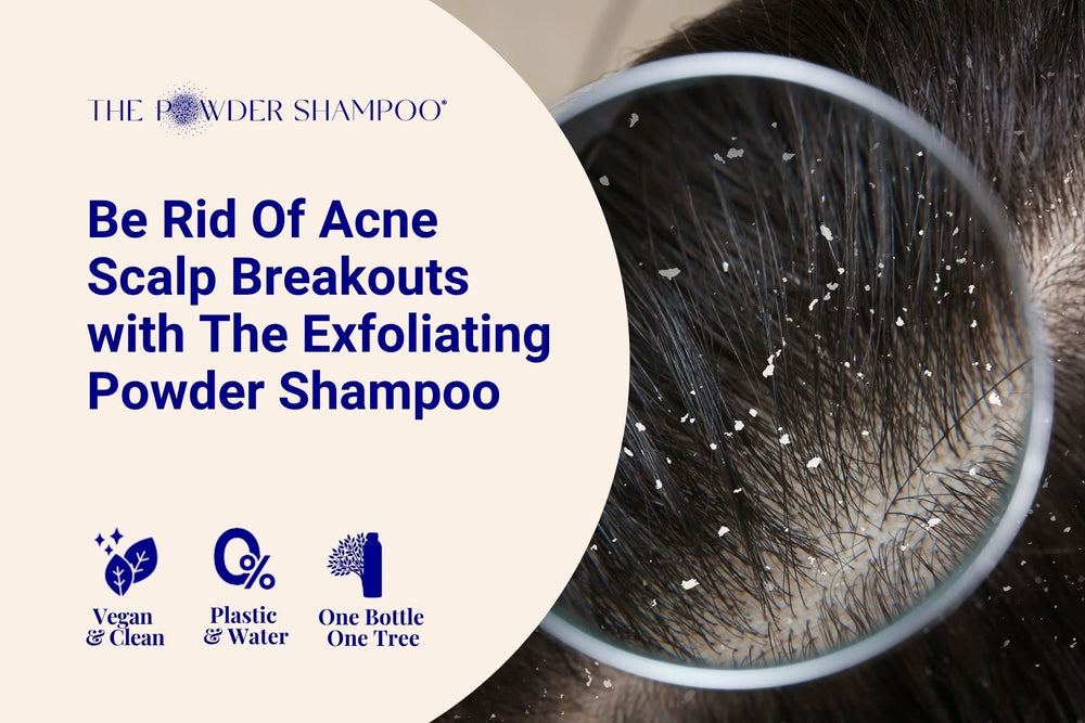 Be Rid Of Acne Scalp Breakouts with The Exfoliating Powder Shampoo ...