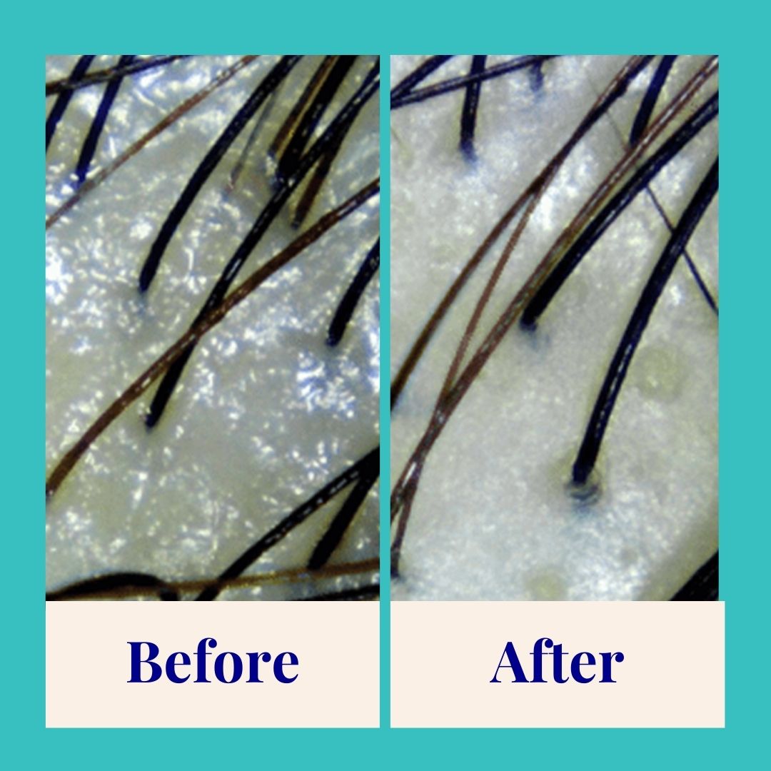 Powder Shampoo For Oily Scalp | THE POWDER SHAMPOO™ – The Powder Shampoo